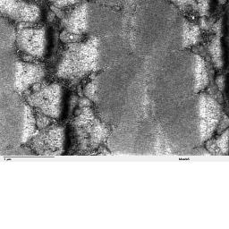 Skeletal Muscle EM