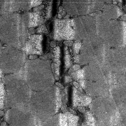 Skeletal Muscle EM