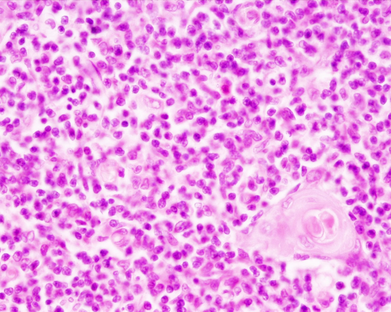 Thymus Histology Drawing Histology Drawings