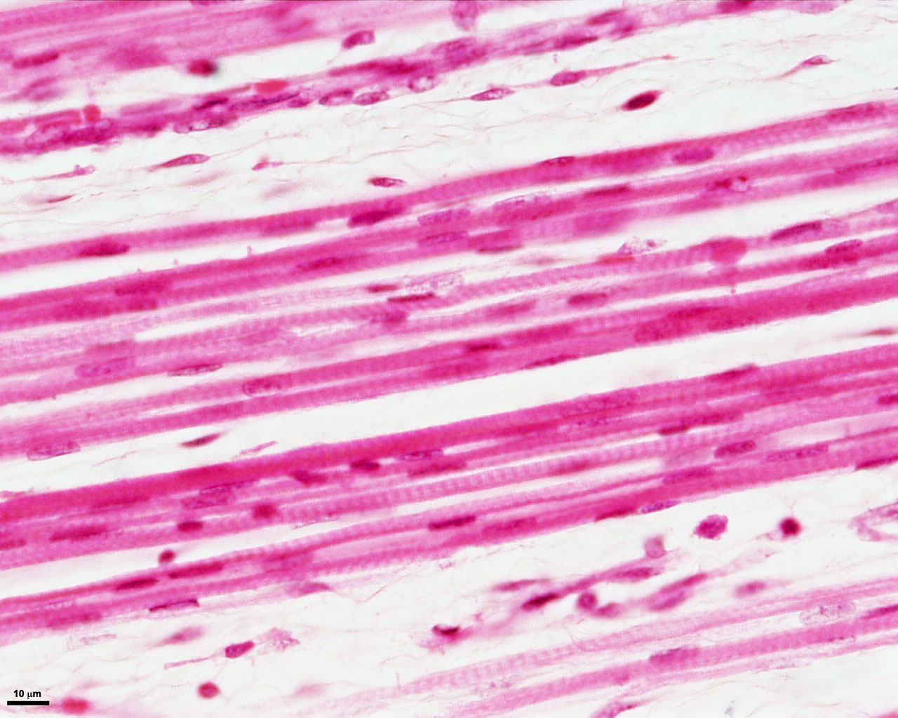Skeletal Muscle Tissue Histology Kenhub