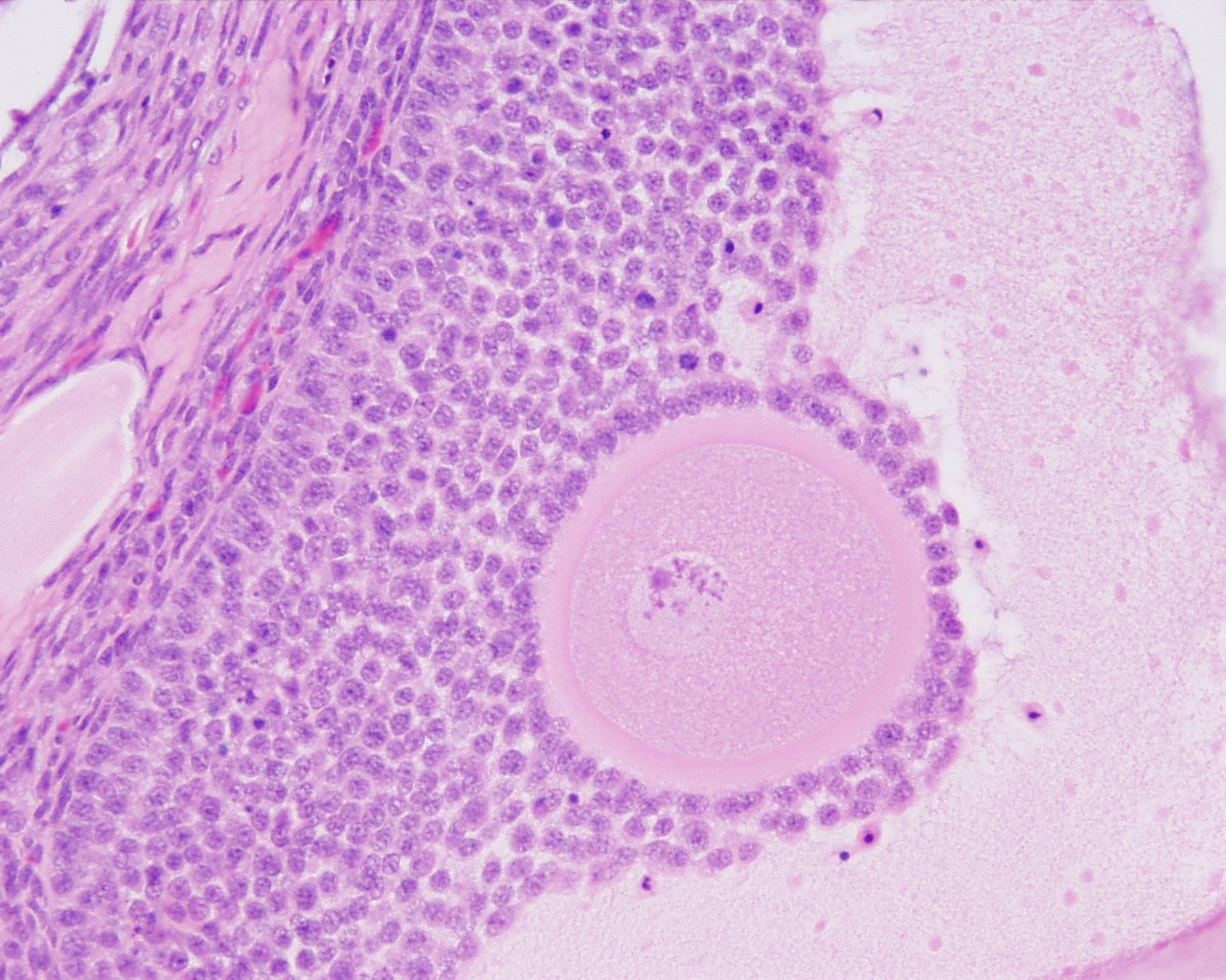 Graafian Follicle Histology Pathology Outlines Anatomy & Histology