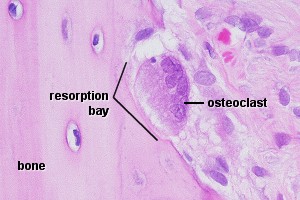 File:Osteoclast.jpg - Embryology
