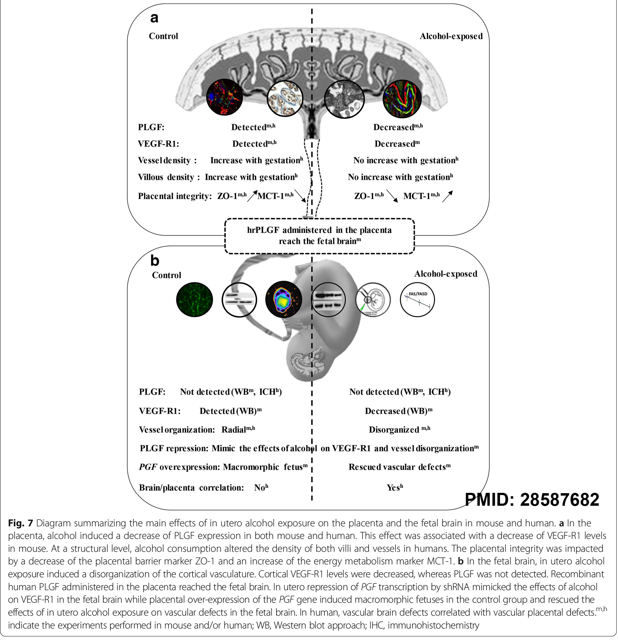 Fetal Alcohol Syndrome Brain NOFAS Webinar: Treating FASD With