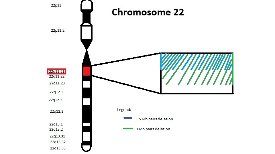 Q 22 Deletion Syndrome