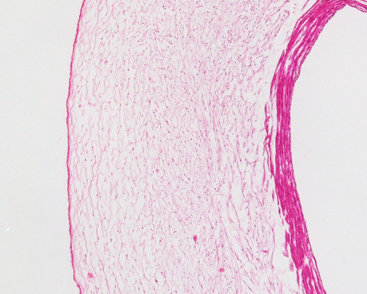 File:Placenta histology 002.jpg - Embryology