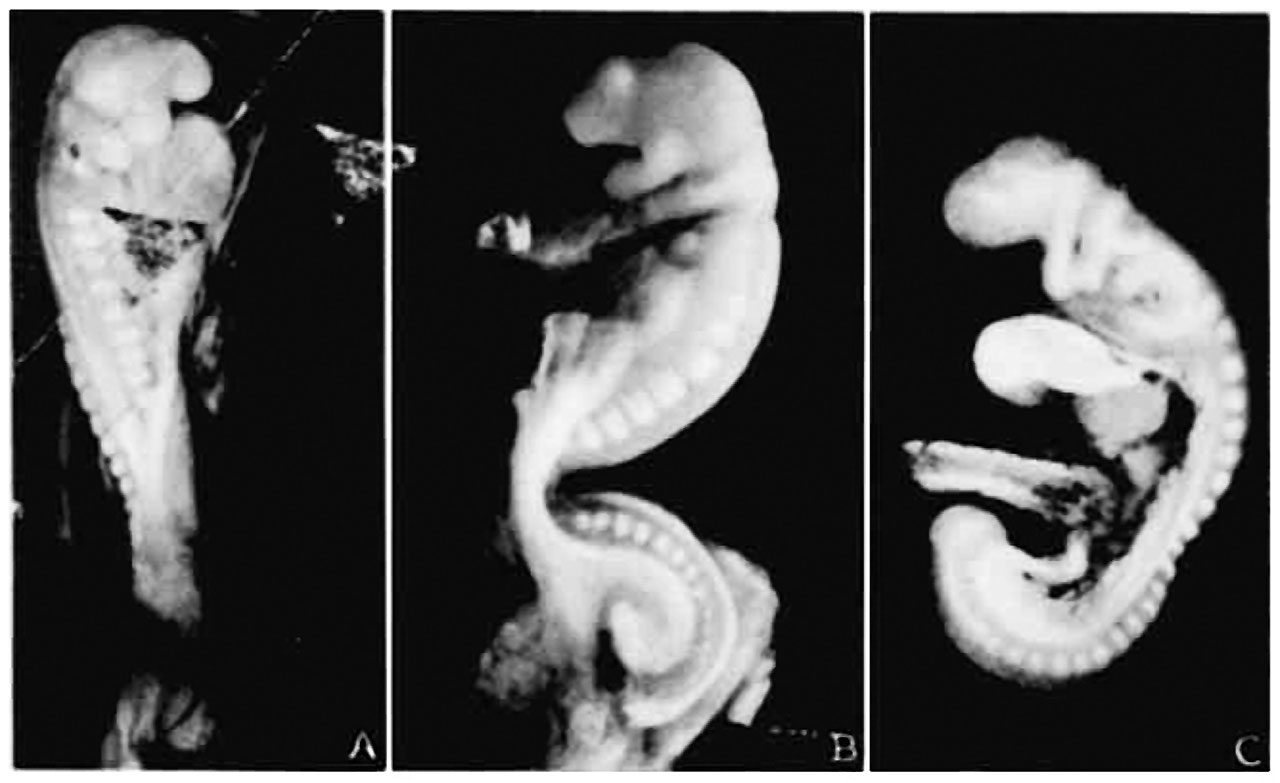 Paper - The Anatomy of Human Embryos with Seventeen to Twenty-three ...