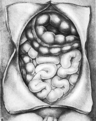 Category:Intestine - Embryology