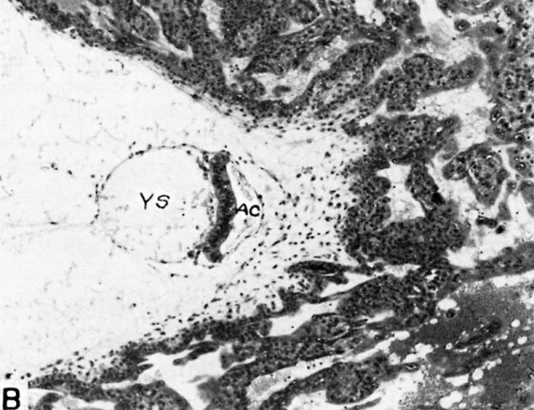 Paper - lnvolution of tissues in fetal life (1946) - Embryology