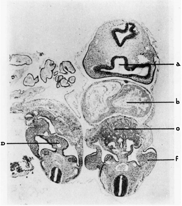 Paper - Observations on two specimens of early human ova - Embryology