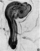 Hamburger Hamilton Stages - Embryology