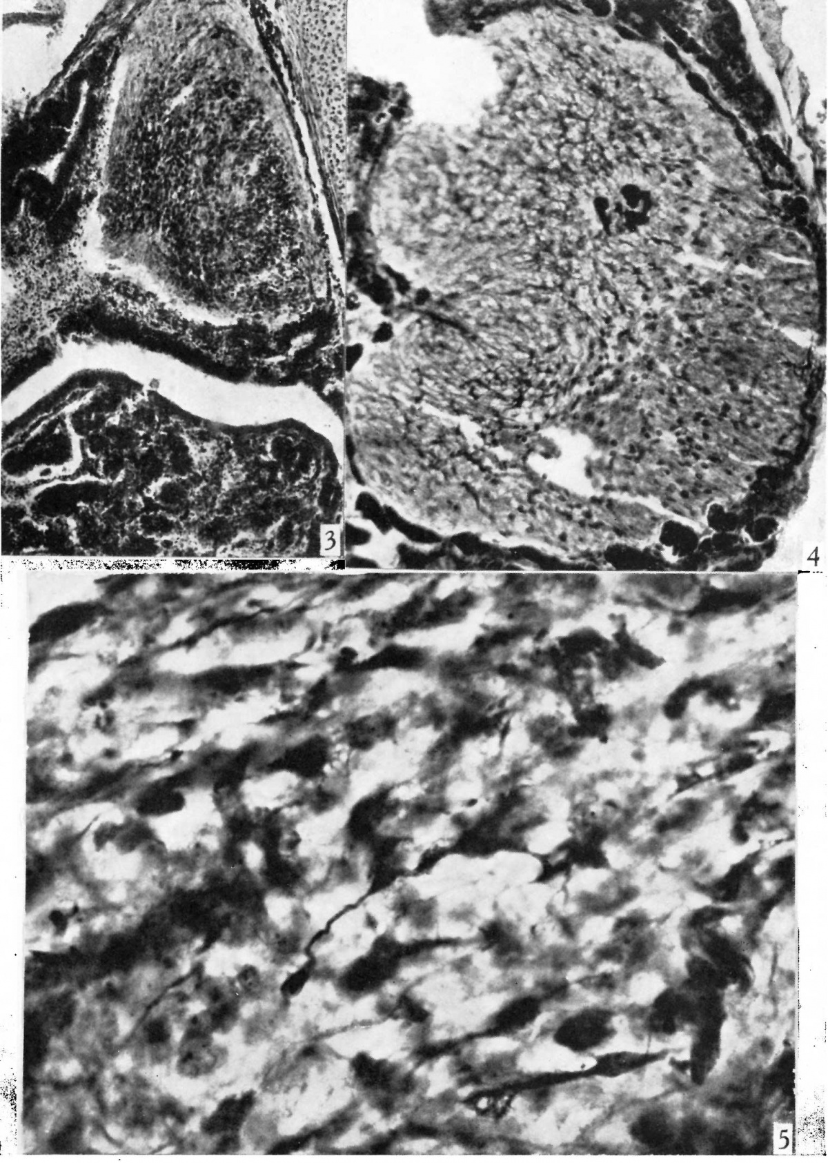 Paper - Differentiation of pituicytes in the human foetus - Embryology