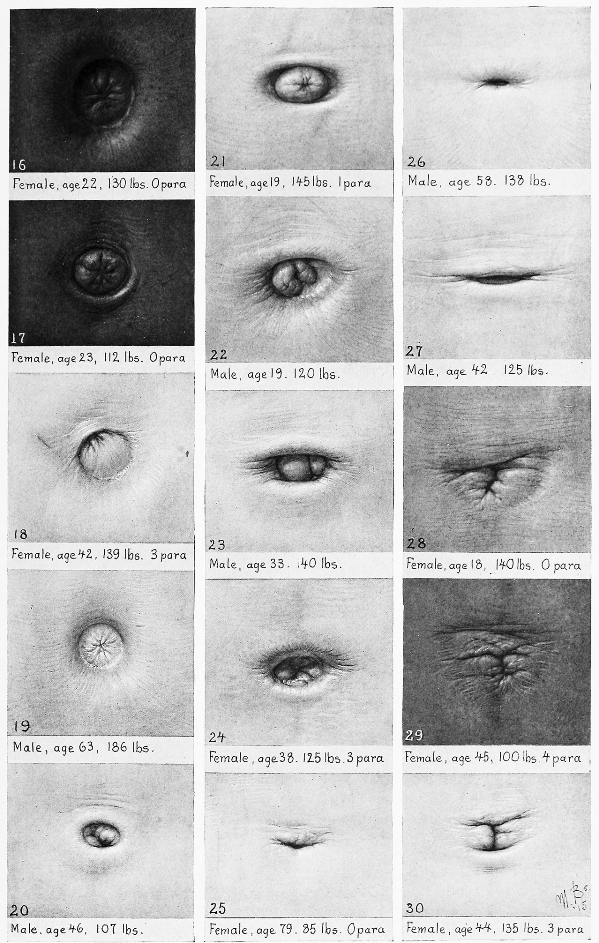Book - Umbilicus (1916) 2 - Embryology