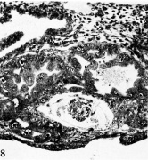 Paper - On the development of the amnion and exocoelomic membrane in ...