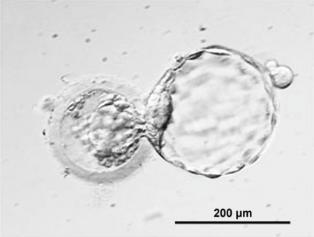Zona pellucida - Embryology