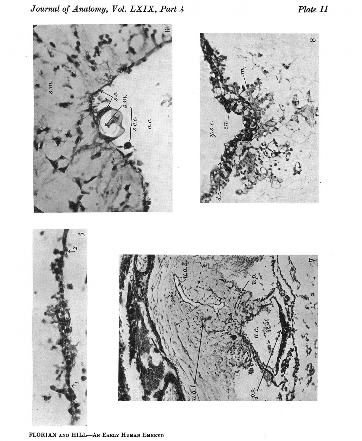 Paper - An Early Human Embryo (No. 1285, Manchester Collection), with ...