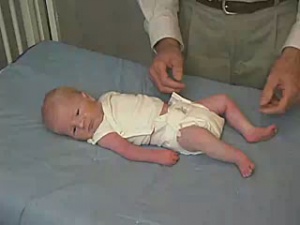 Neural Abnormal Exam - Newborn tone - leg recoil - Embryology