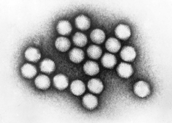 Abnormal Development - Viral Infection - Embryology