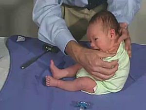 Neural Exam - Newborn reflexes - Moro - Embryology