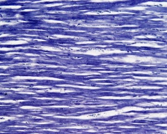 HM Practical - Cardiac Histology - Embryology