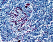 Gastrointestinal Tract - Pancreas Histology - Embryology