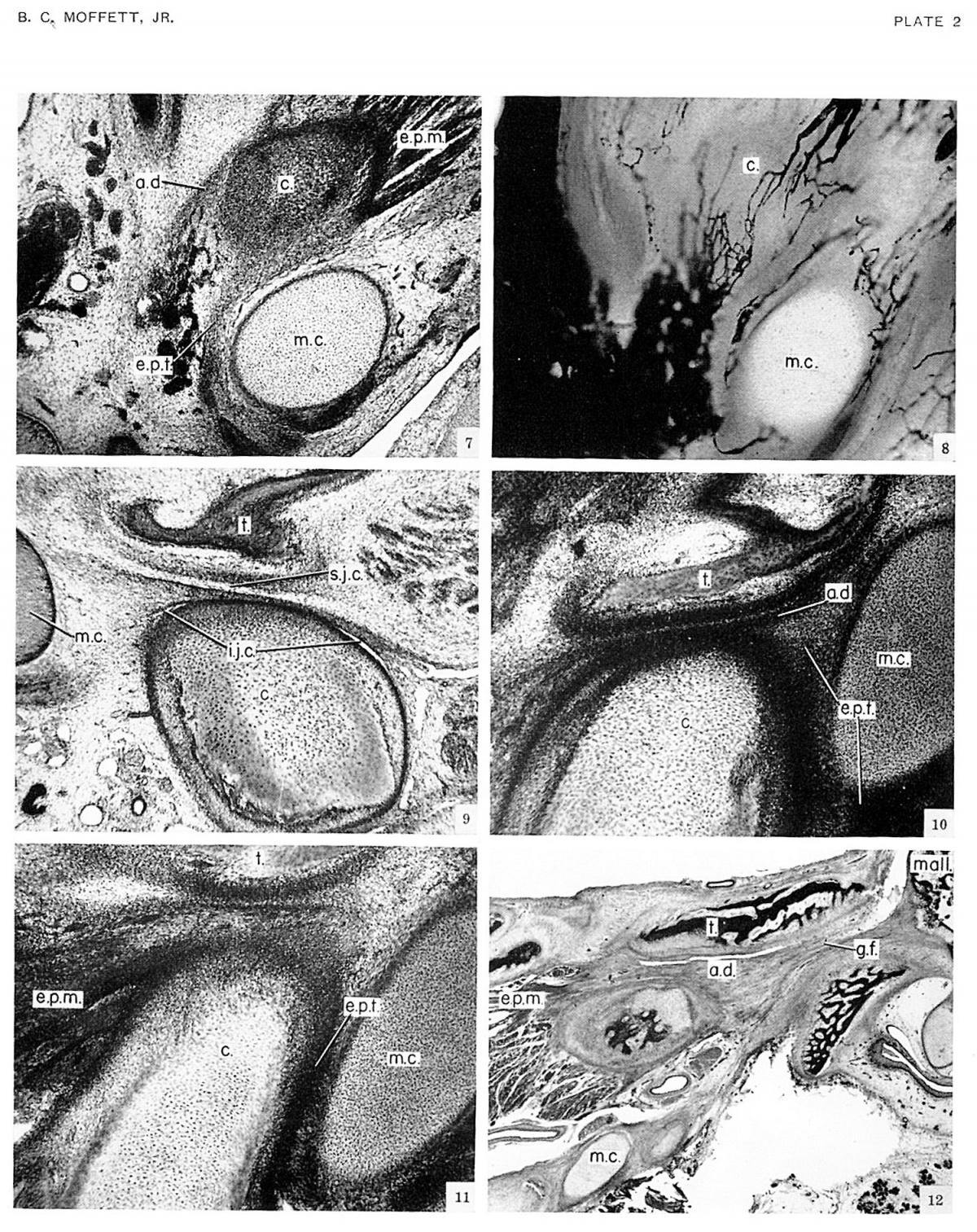 Paper - The prenatal development of the human temporomandibular joint ...