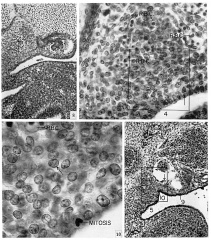 Category:Carnegie Stage 15 - Embryology