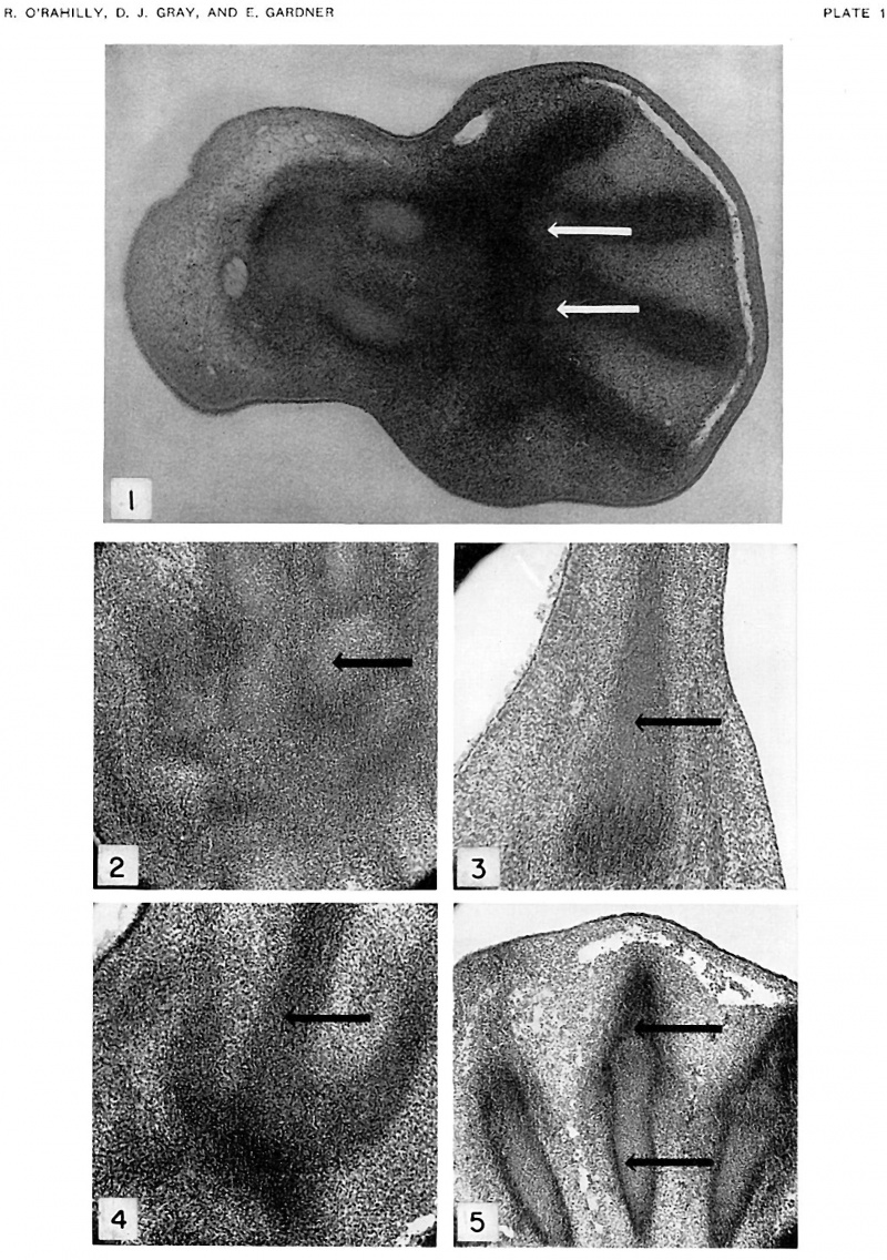 Paper - Chondrification in the hands and feet of staged human embryos ...