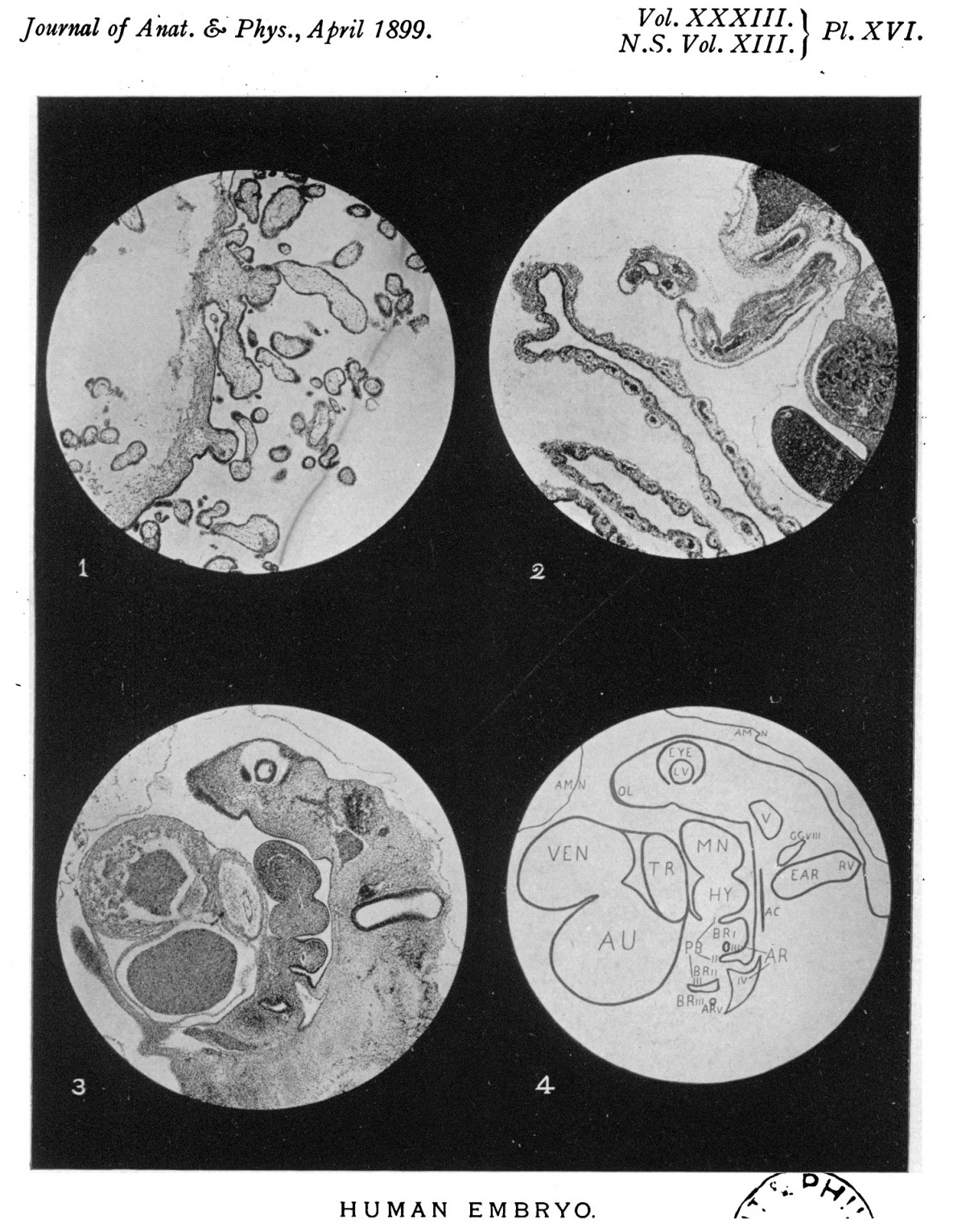 Paper - Photographs of a Series of Sections of an Early Human Embryo ...