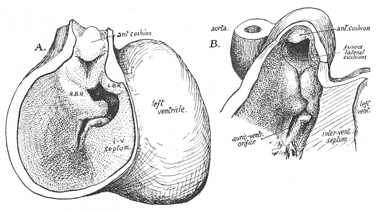 Paper - The Formation of the Pars Membranacea Septi (1916) - Embryology