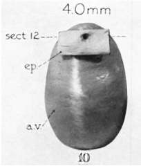 Category:Placode - Embryology