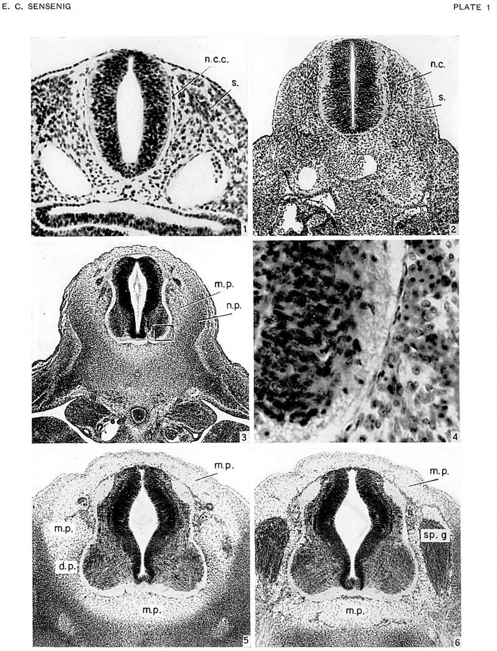 Paper - The early development of the meninges of the spinal cord in ...