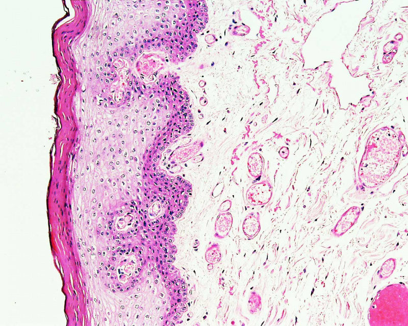 ANAT2241 Integumentary System - Embryology
