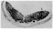 Monkey Development - Embryology