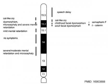 Monosomy - Embryology