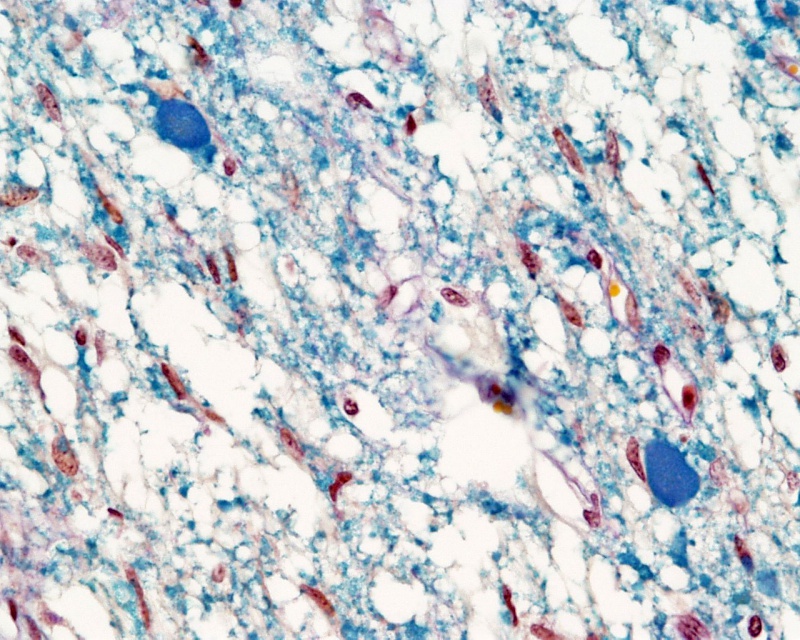 Endocrine - Pituitary Development - Embryology
