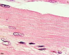Skeletal Muscle Histology - Embryology
