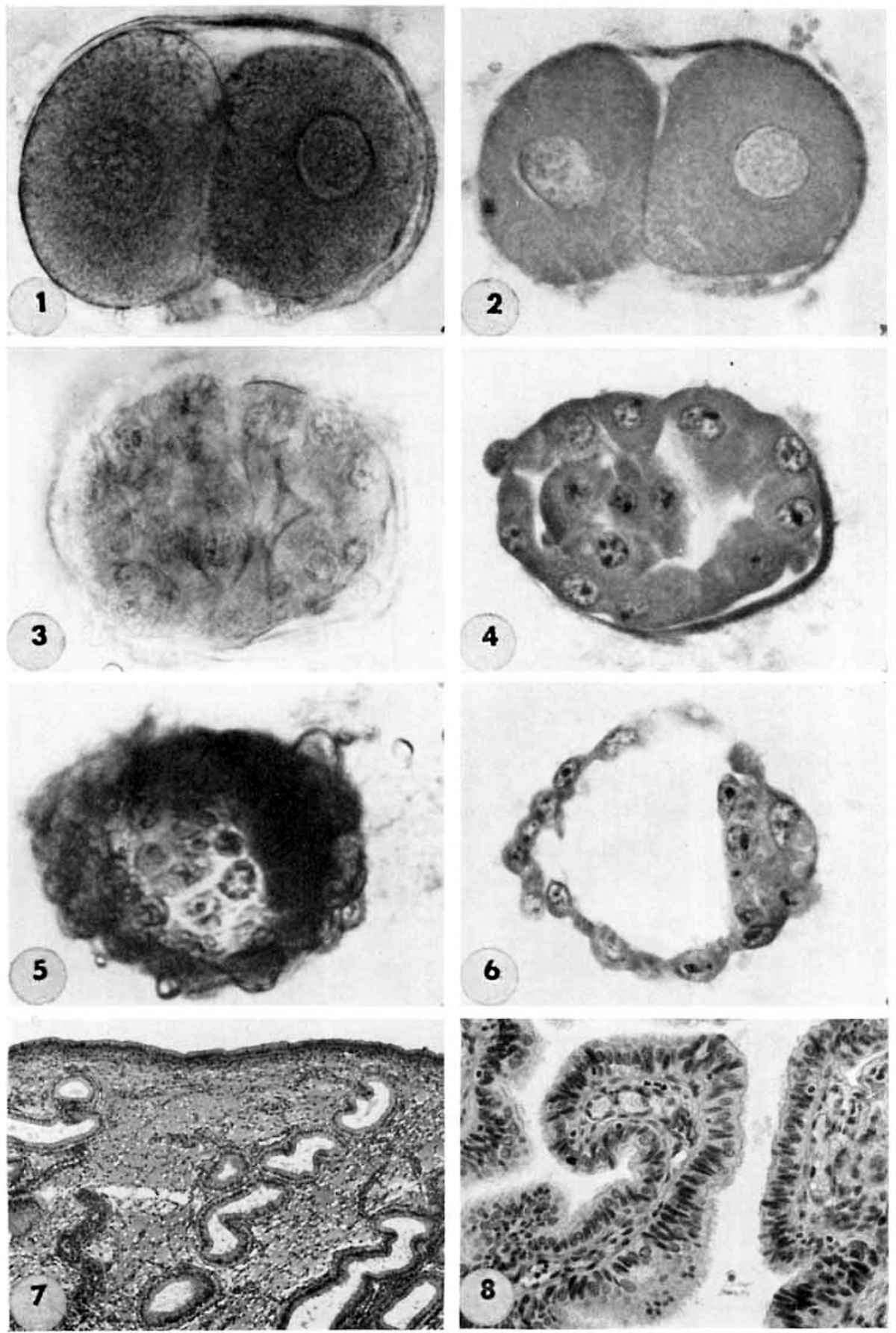 Paper - A description of 34 human ova within the first 17 days of ...