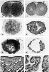 Paper - A description of 34 human ova within the first 17 days of ...
