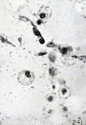 Placenta - Cord - Embryology