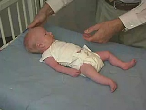 Neural Abnormal Exam - Newborn tone - head lag - Embryology