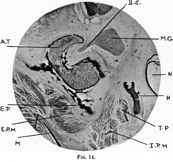 Paper - Notes on the development of the human sphenoid (1910) - Embryology