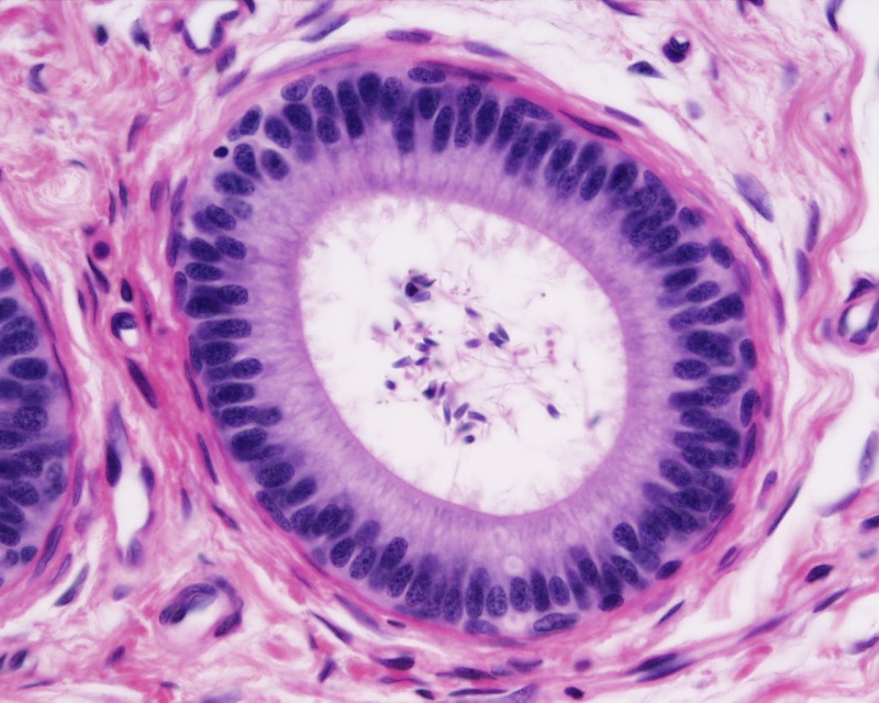 ANAT2241 Covering and Lining Epithelia - Embryology