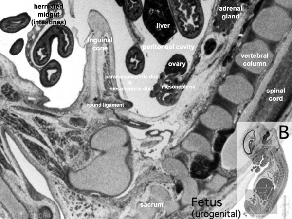 Genital - Female Development - Embryology