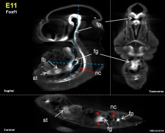 Category:Mouse E11 - Embryology