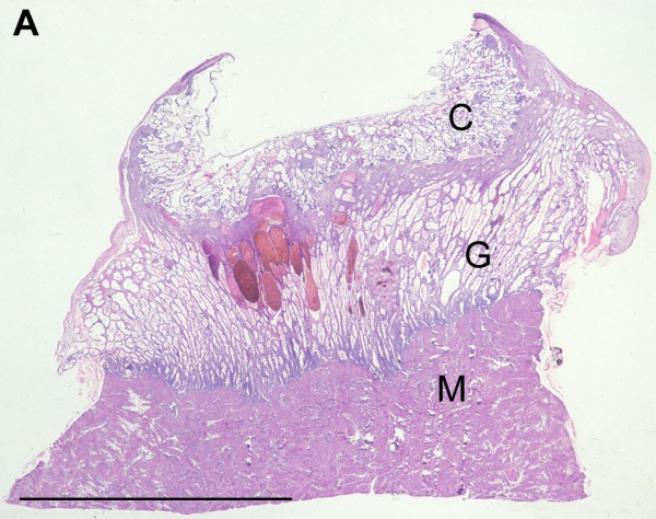 Placenta Development - Embryology