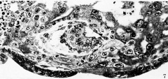 Paper - On the development of the amnion and exocoelomic membrane in ...