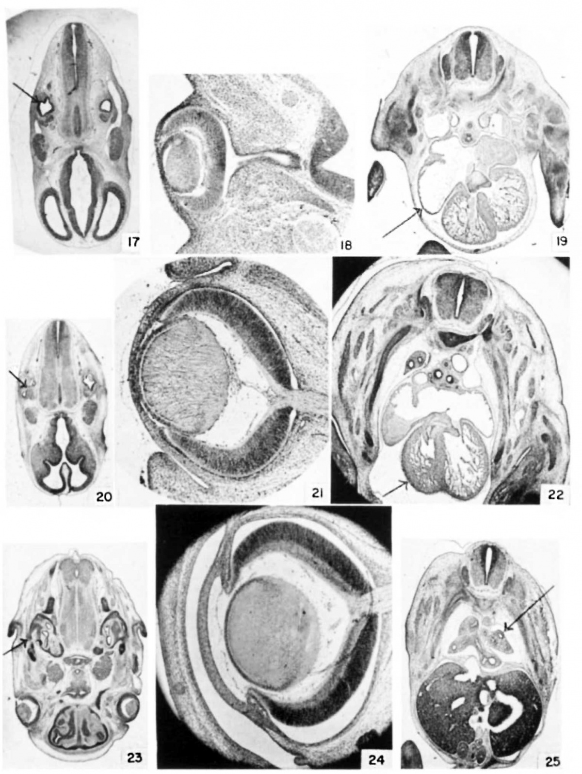Paper - Equivalent ages in mouse and human embryos - Embryology
