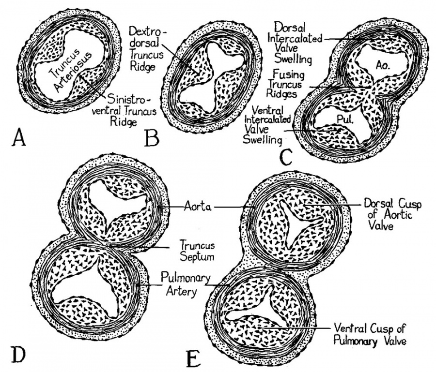 Paper - The partitioning of the truncus and conus and the formation of ...
