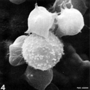 Thymus Development - Embryology