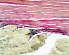 Skeletal Muscle Histology - Embryology